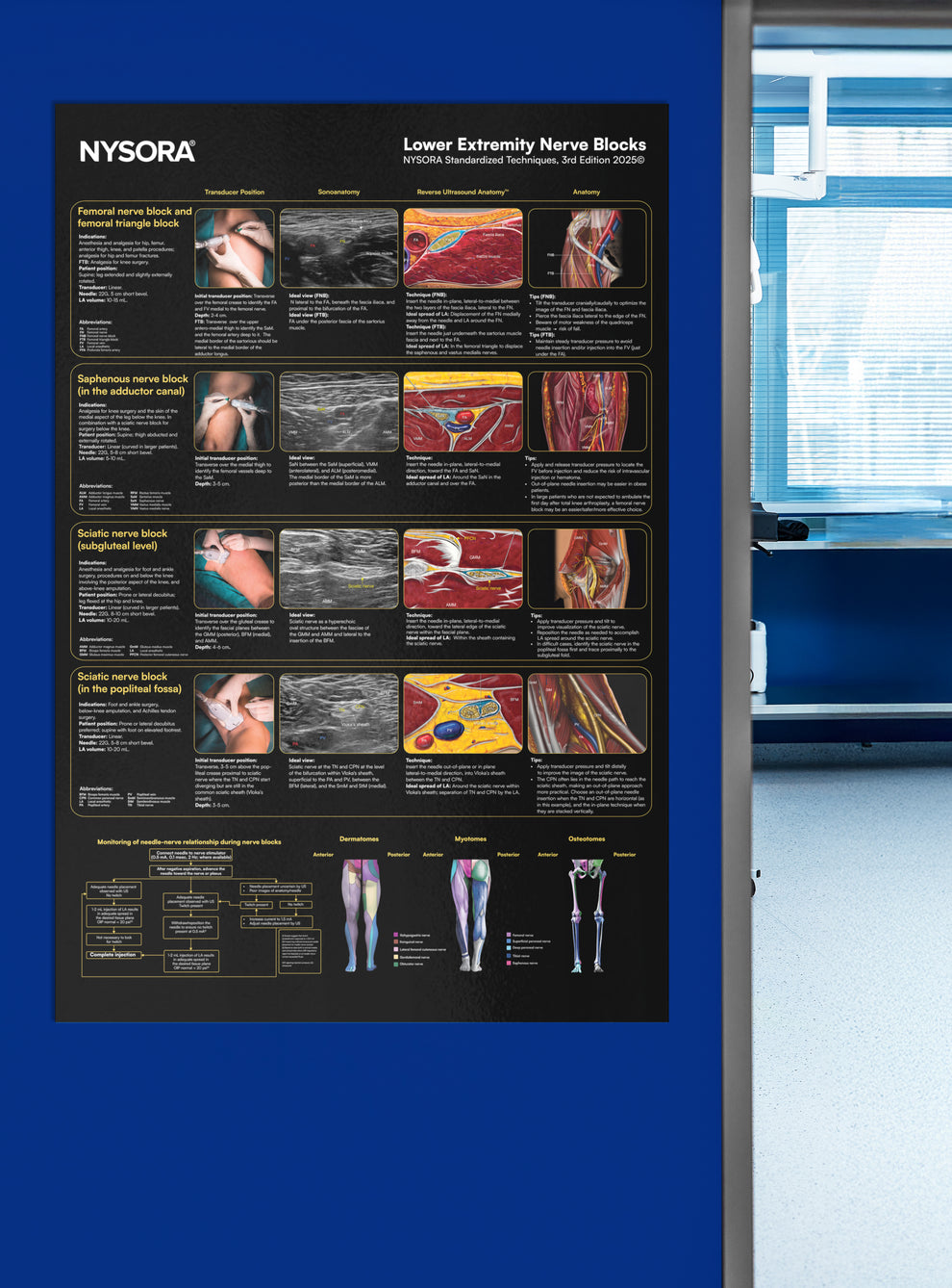 Lower Extremity Nerve Blocks Poster – NYSORA